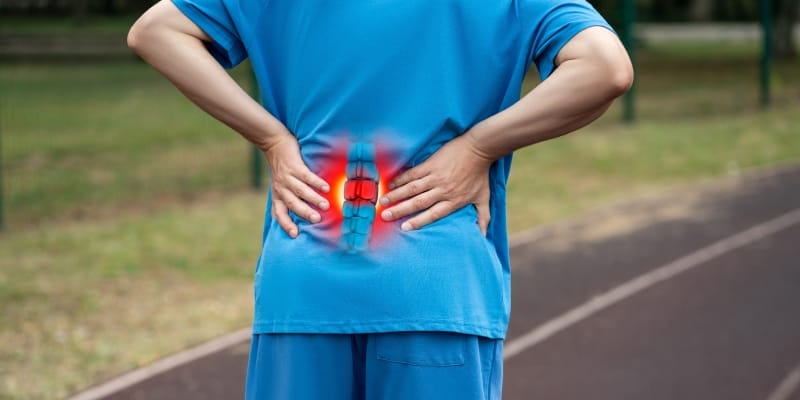 What Is Multilevel Spondylosis? A Guide To Spine Health